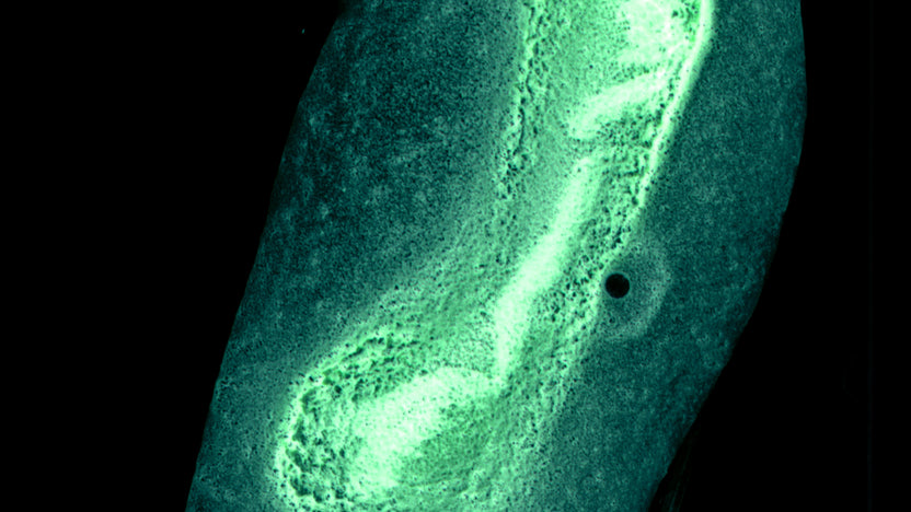 Dirty analog textures & transitions | ACIDBITE